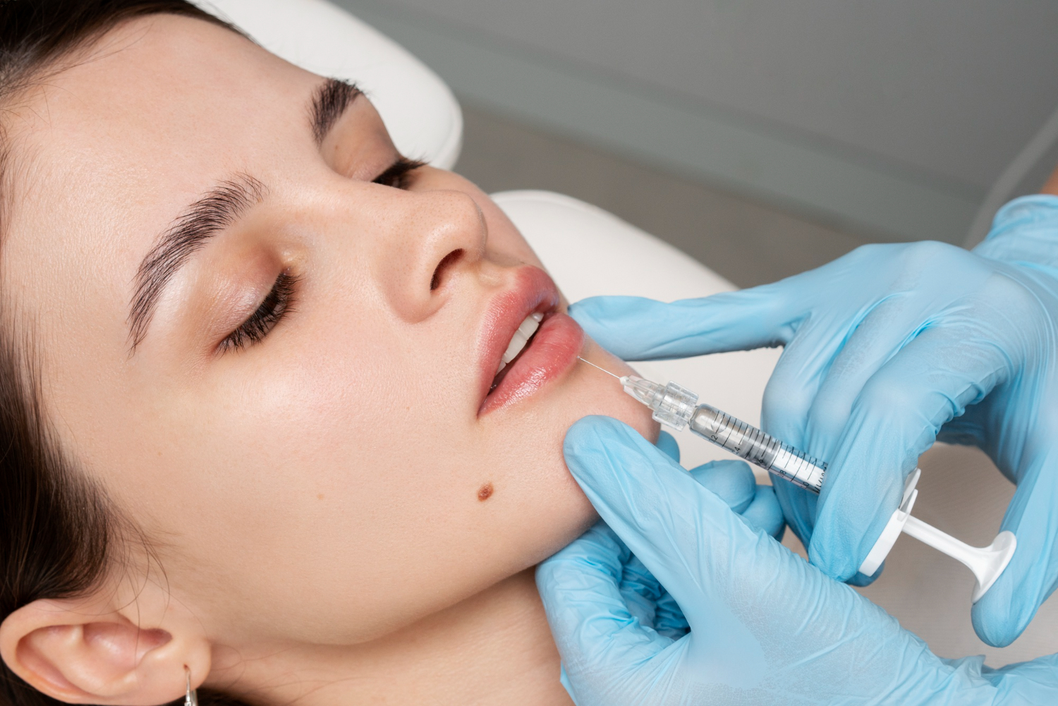 Understanding Dermal Fillers: Types and Benefits Understanding Dermal Fillers: Types and Benefits
